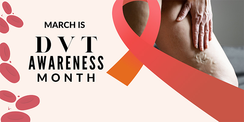 Celebrities who Survived Deep Vein Thrombosis (DVT)s